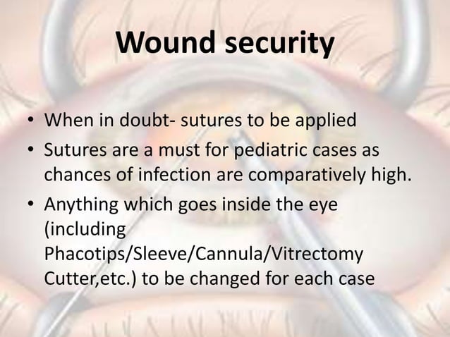 Prevention of Intraocular Infection in Pre-op and Post-op Ocular ...