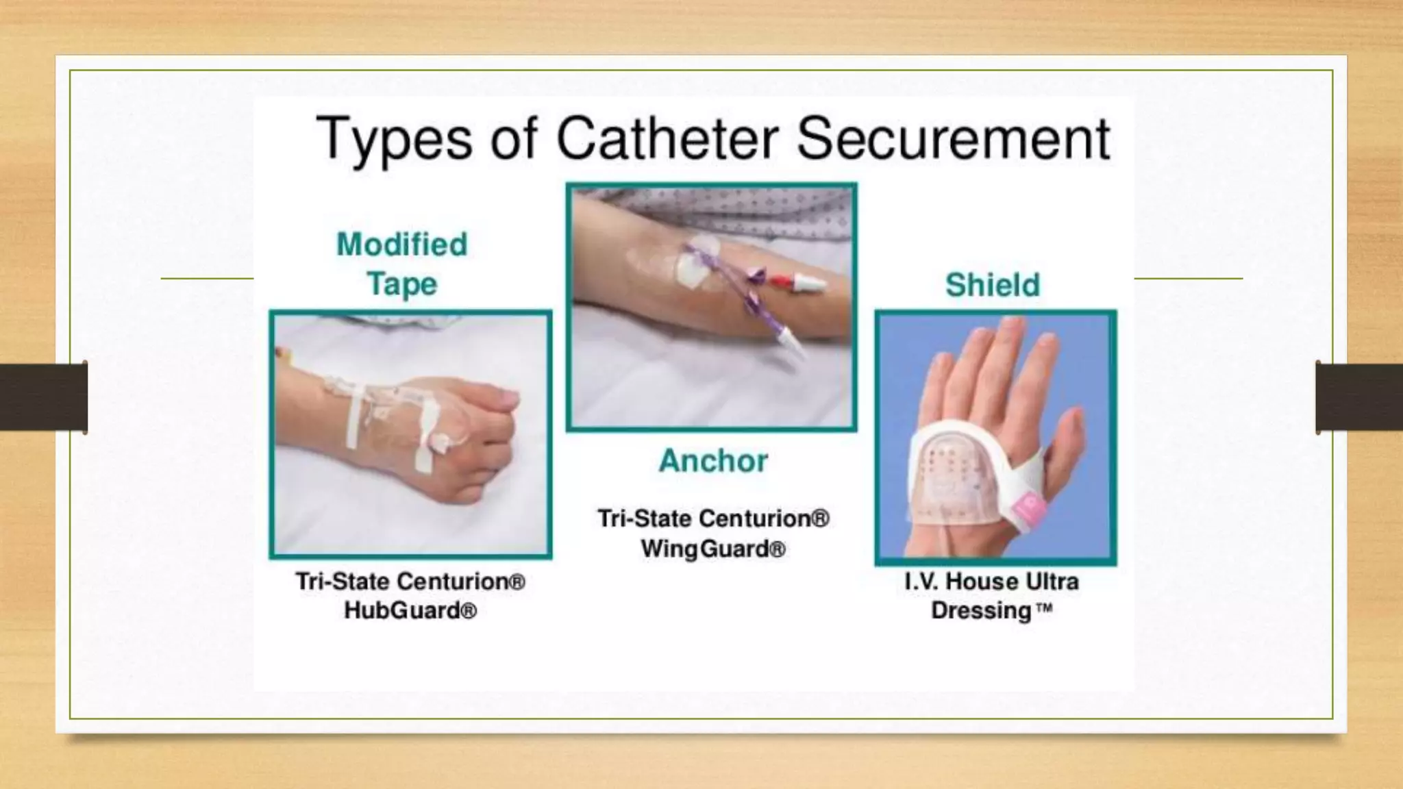 Prevention of iv complication | PPTX