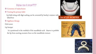 Prevention of oral habits | PPTX