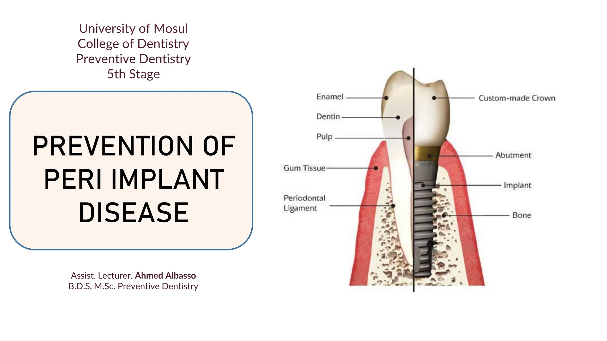 prevention of peri implant disease 8.pdf