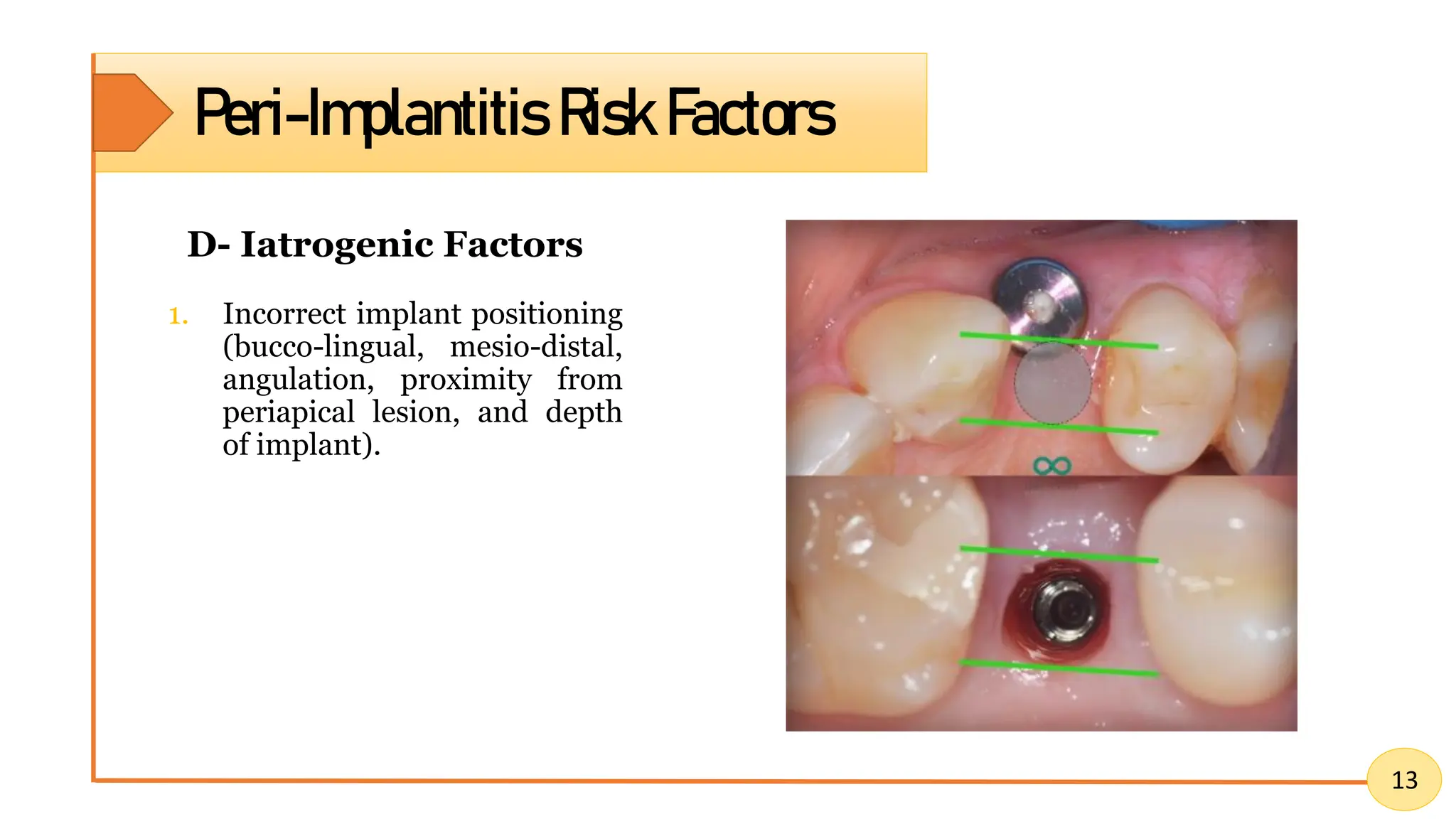 prevention of peri implant disease 8.pdf