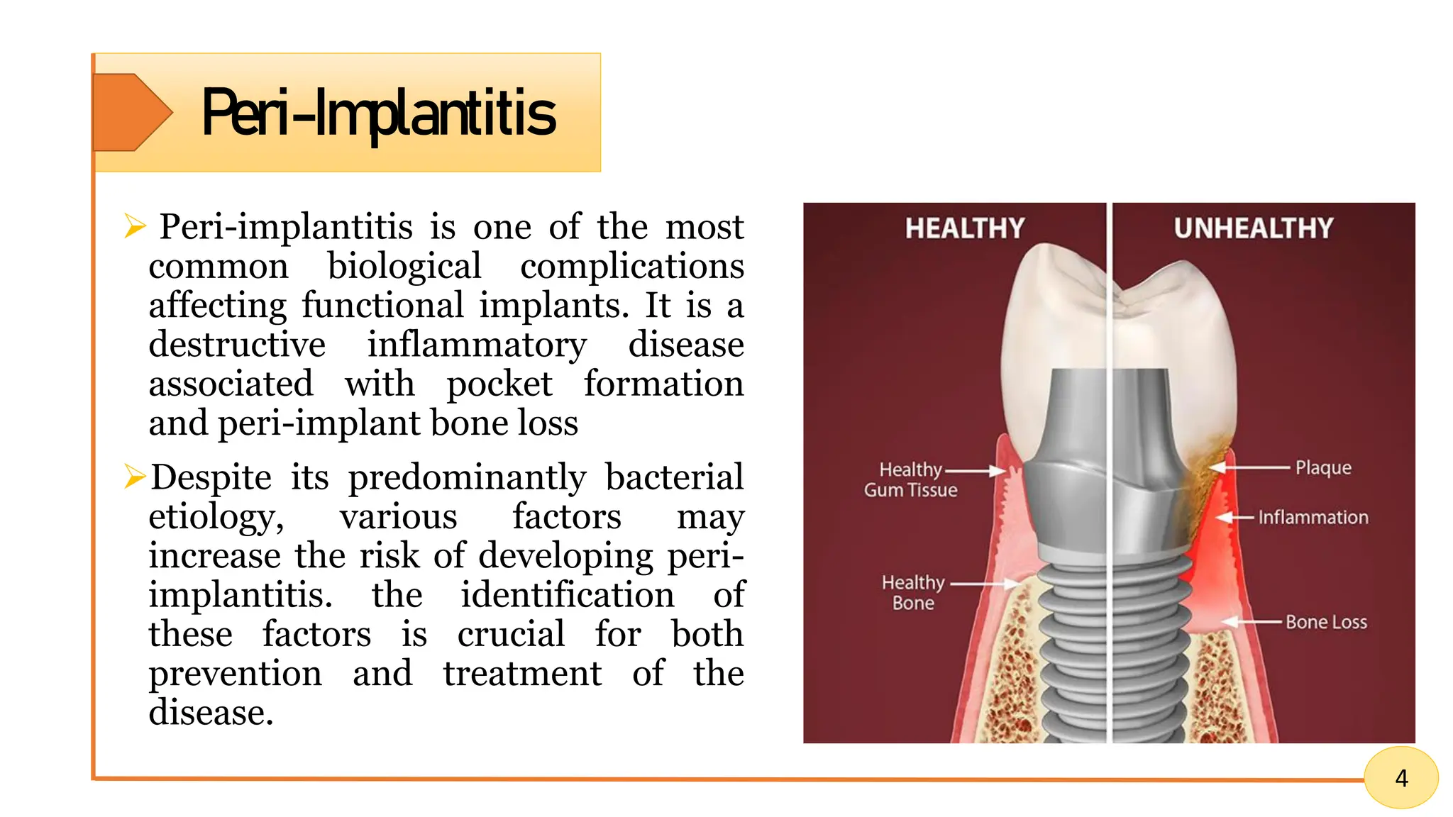 prevention of peri implant disease 8.pdf