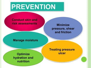 PREVENTION OF PRESSURE ULCER/BED SORE/PRESSURE SORE | PPTX