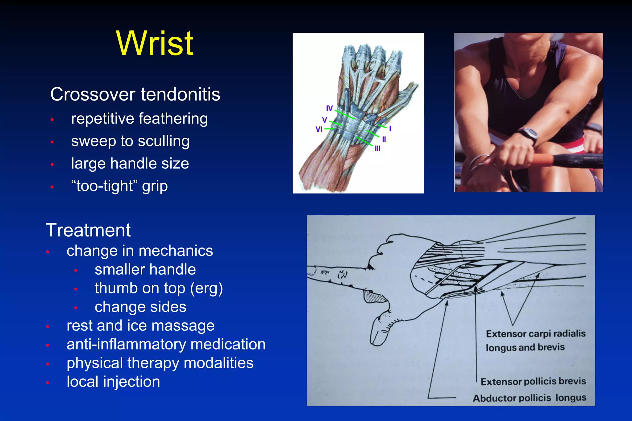 Prevention of Rowing Injury | PDF