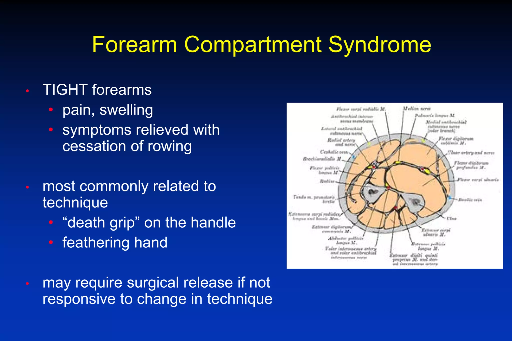Prevention of Rowing Injury | PDF