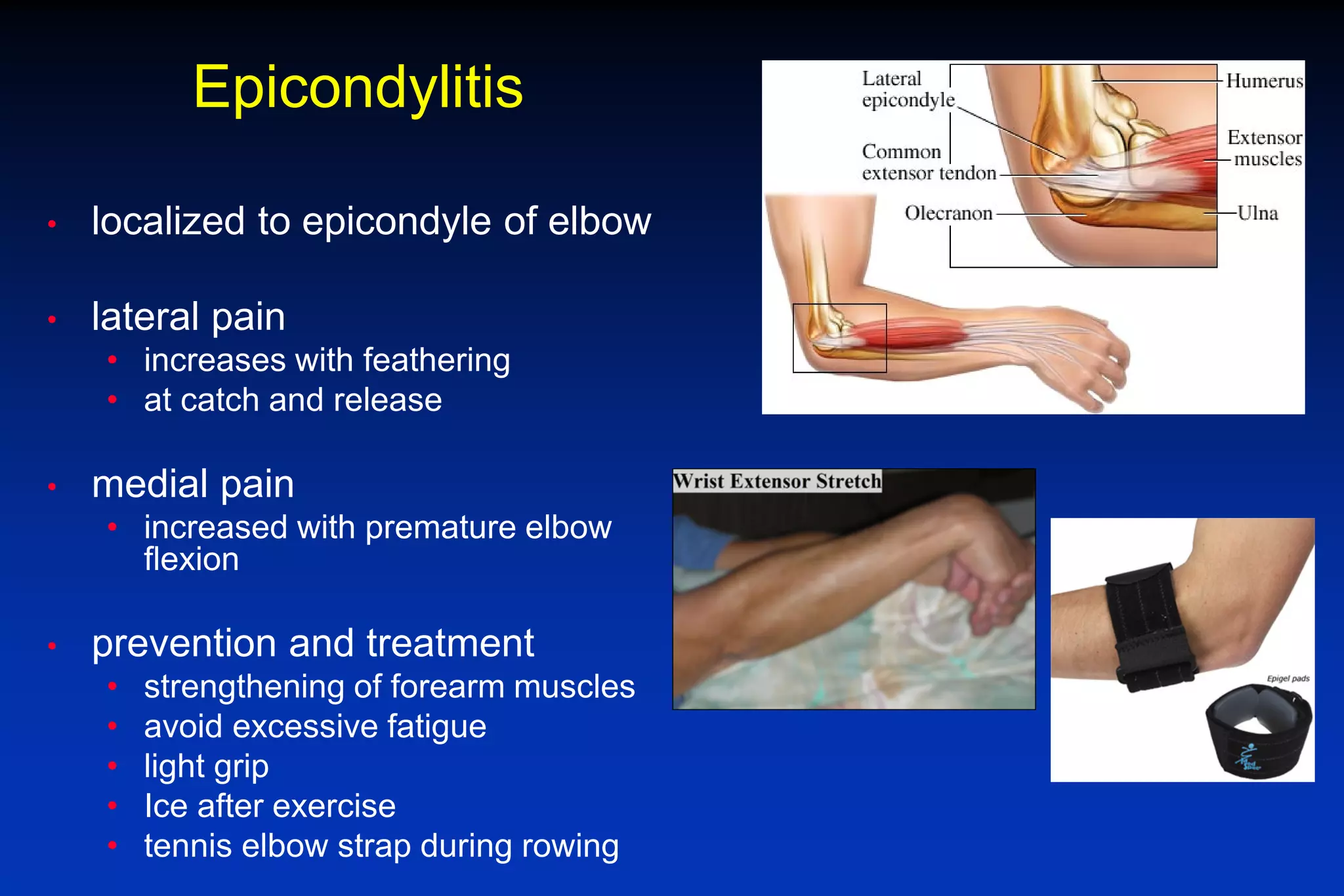 Prevention of Rowing Injury | PDF