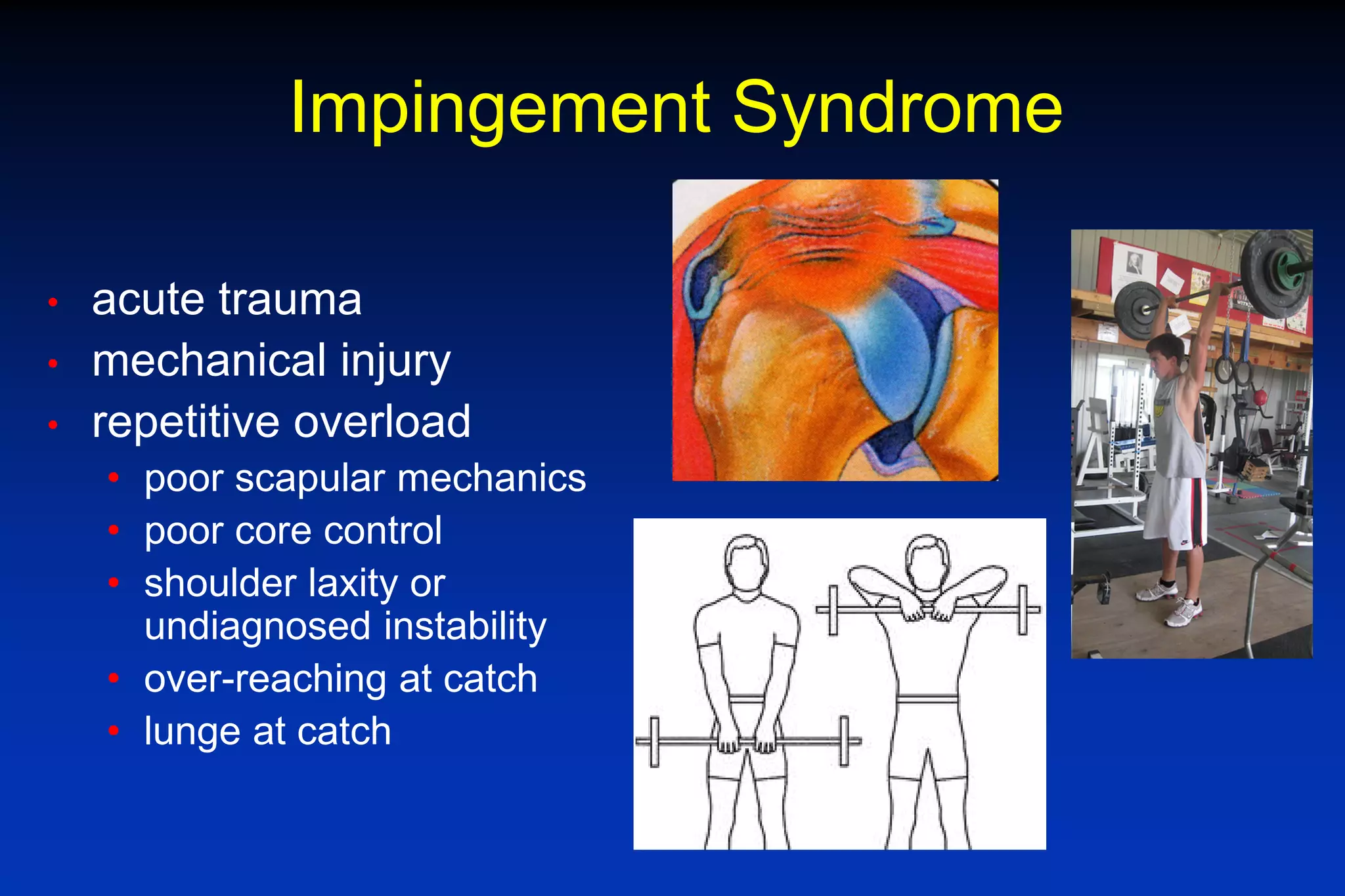 Prevention of Rowing Injury | PDF