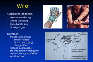 Prevention of Rowing Injury | PDF