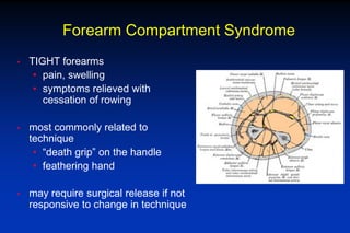 Prevention of Rowing Injury | PDF