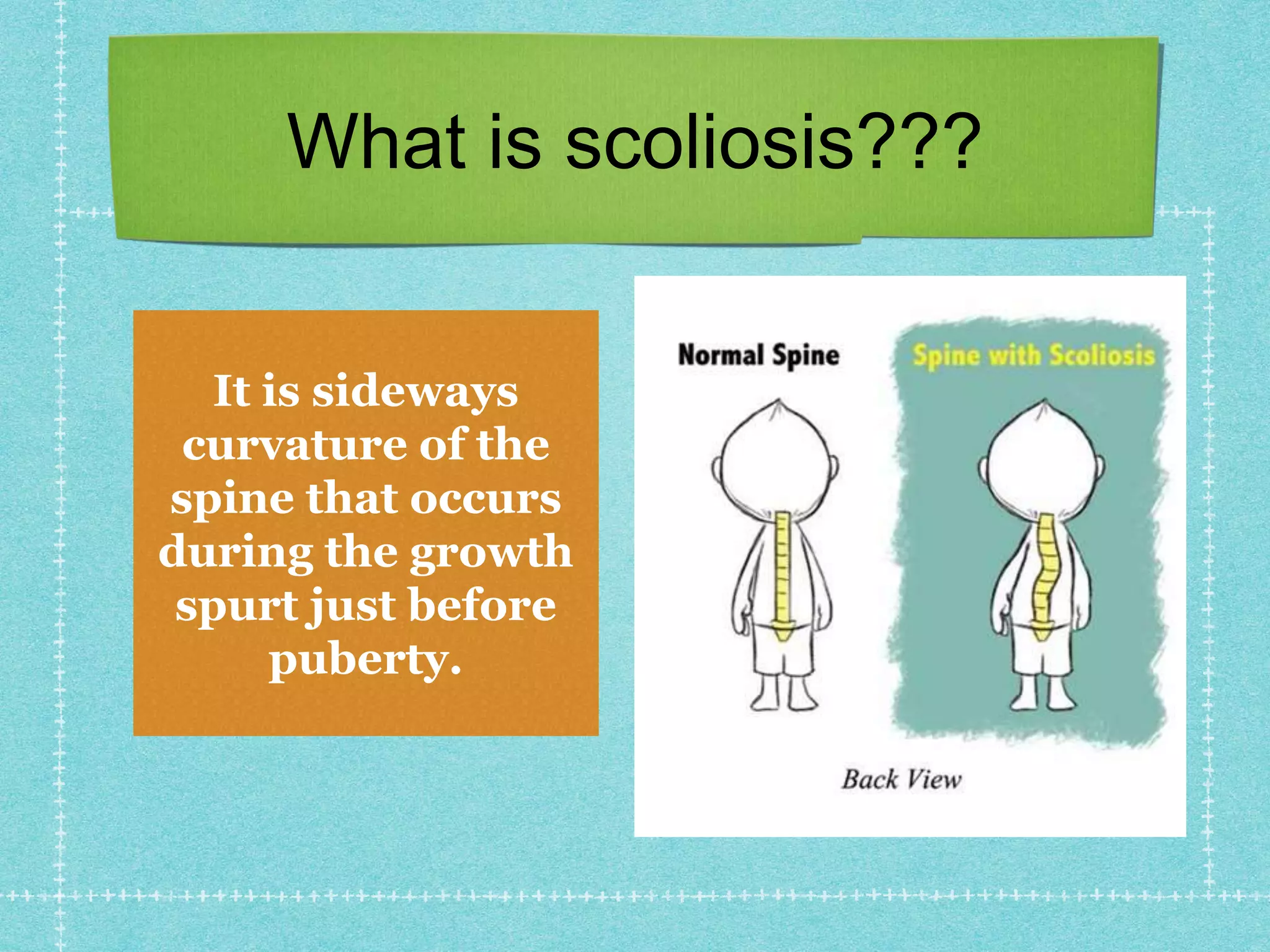 Prevention of spine deformities in children and adults ( Scoliosis ...