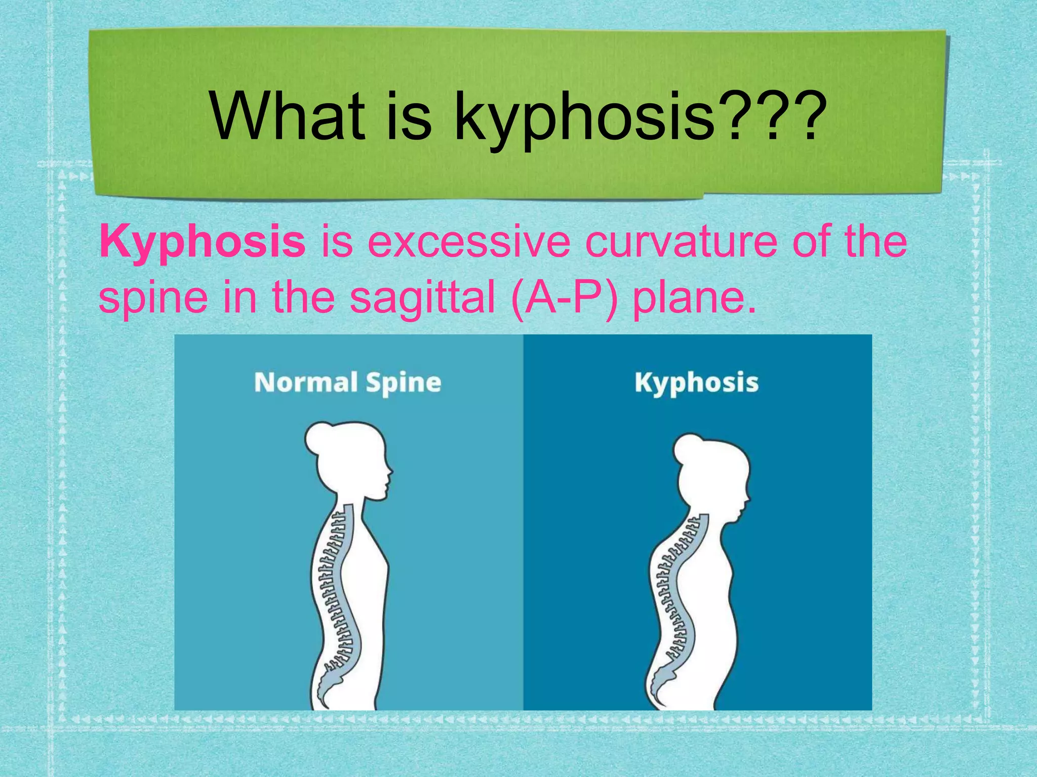 Prevention of spine deformities in children and adults ( Scoliosis ...