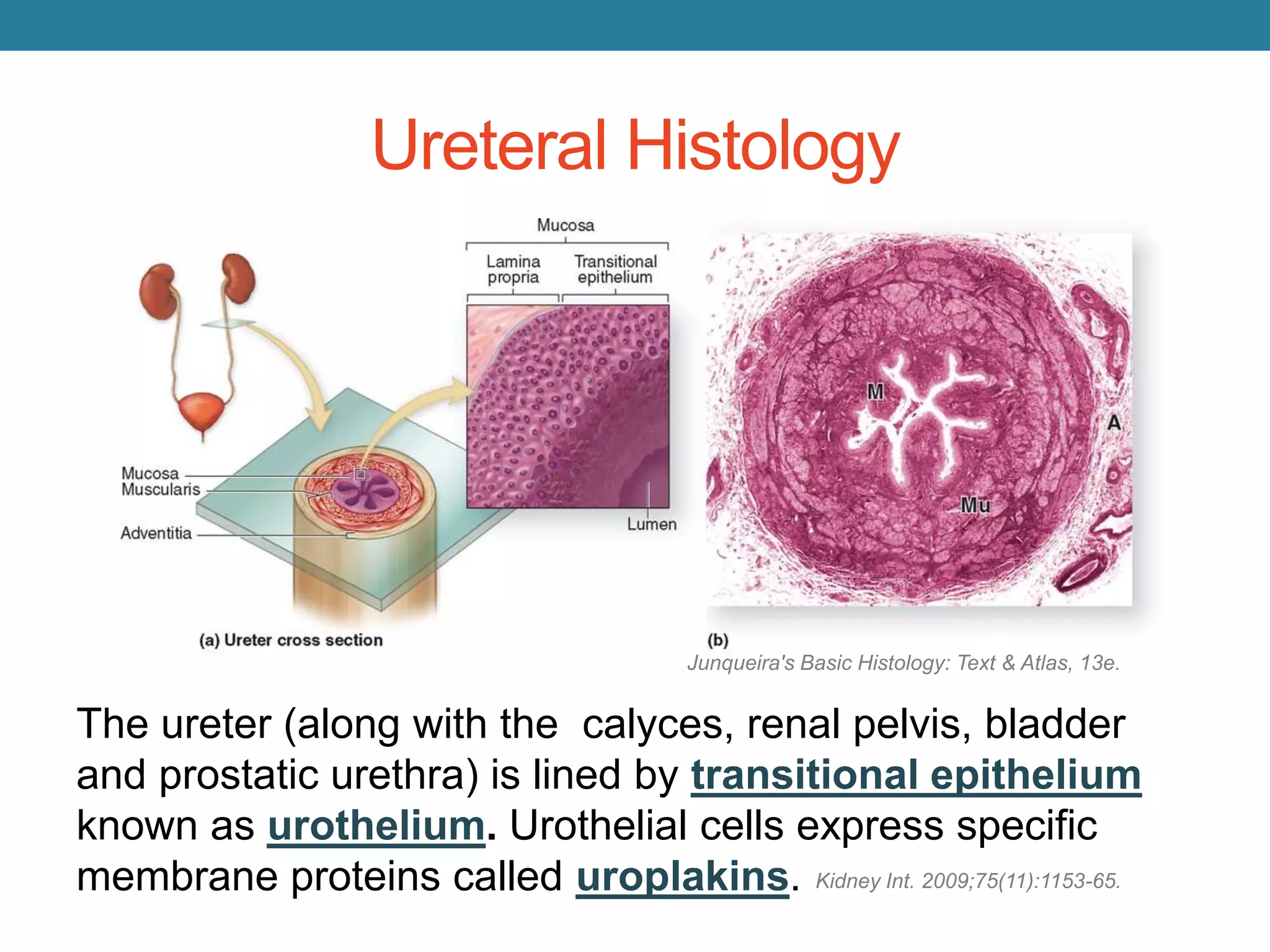 Prevention of Ureteral Injury 2014 - En'wezoh | PPTX