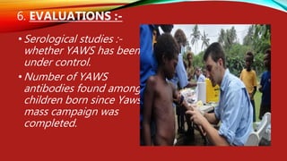 Prevention of yaws roge ppt | PPT