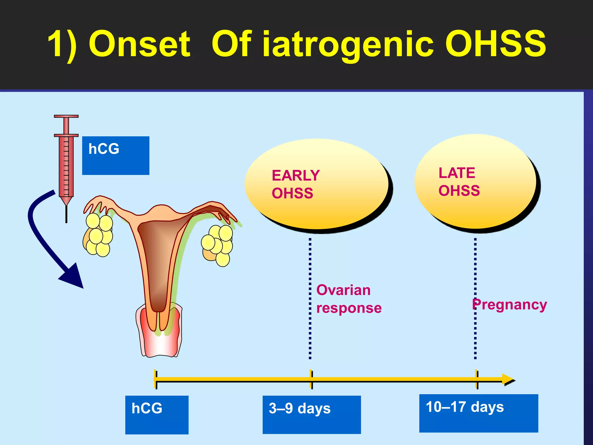 Prevention of Ovarian Hyperstimulation Syndrome ( OHSS ) | PDF