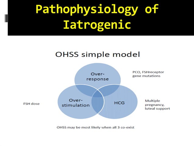 Prevention of Ovarian Hyperstimulation Syndrome ( OHSS ) | PDF