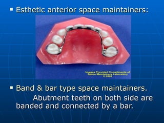 Preventive And Interceptive Orthodontics | PPT