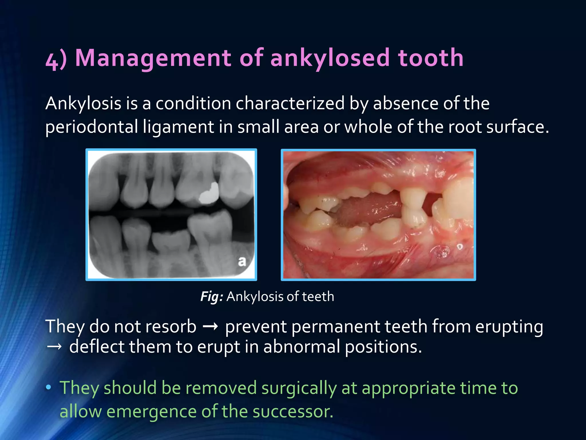 Preventive and interceptive orthodontics (basic) | PPTX
