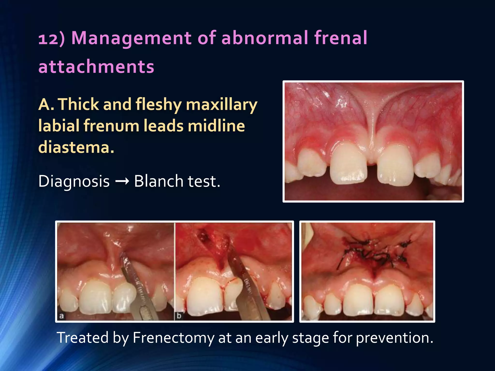 Preventive and interceptive orthodontics (basic) | PPTX