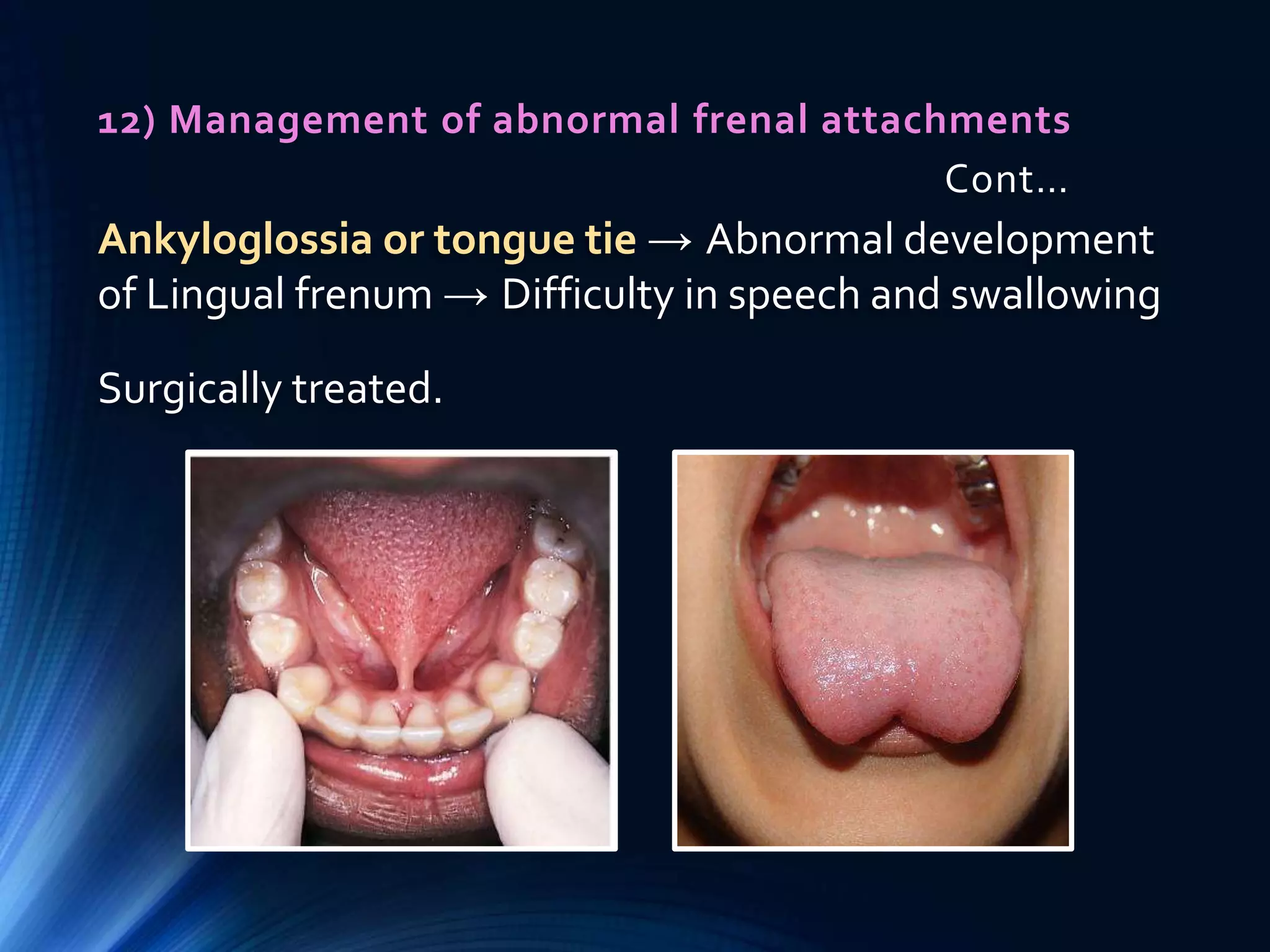 Preventive and interceptive orthodontics (basic) | PPTX