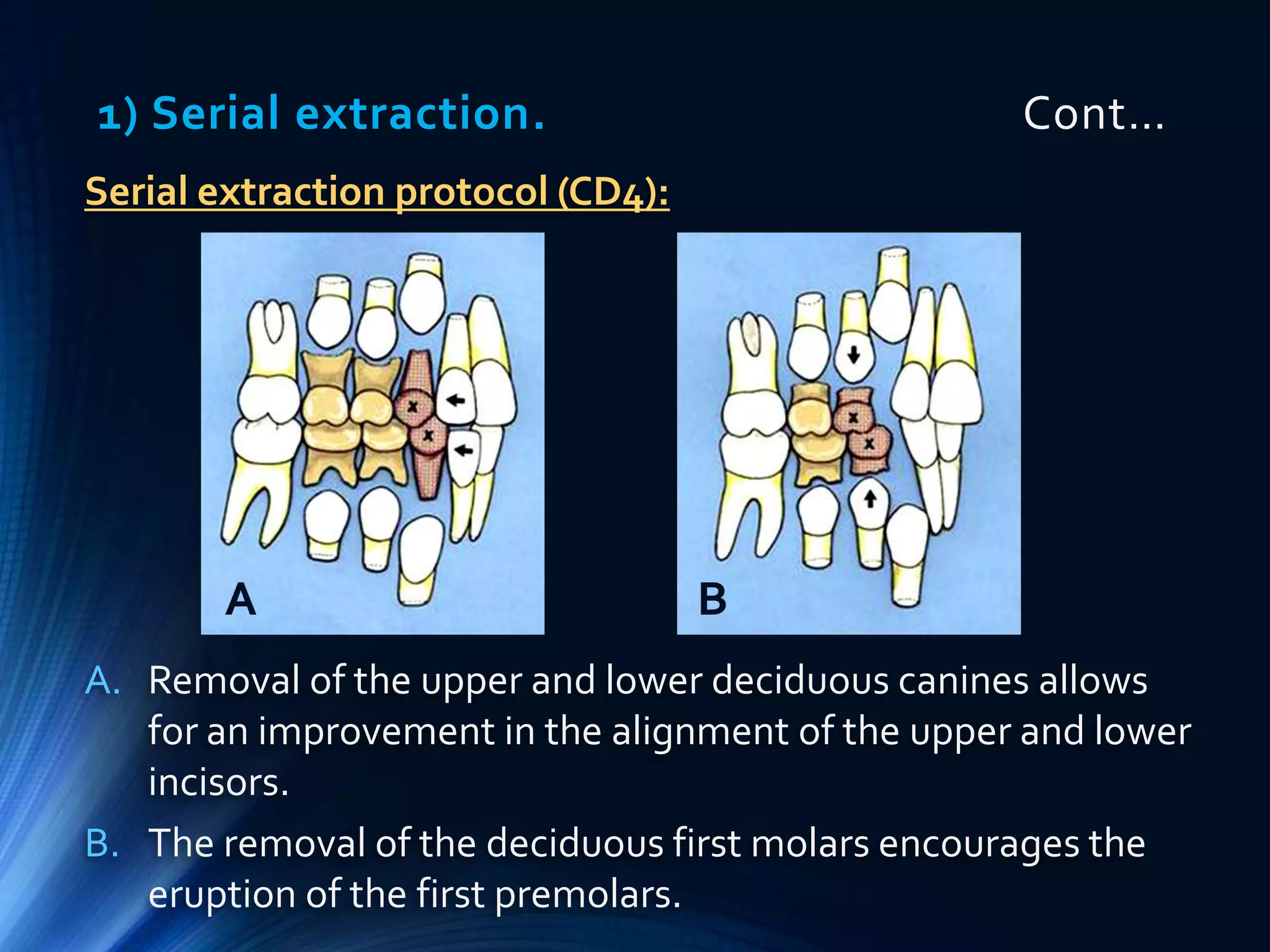 Preventive and interceptive orthodontics (basic) | PPTX
