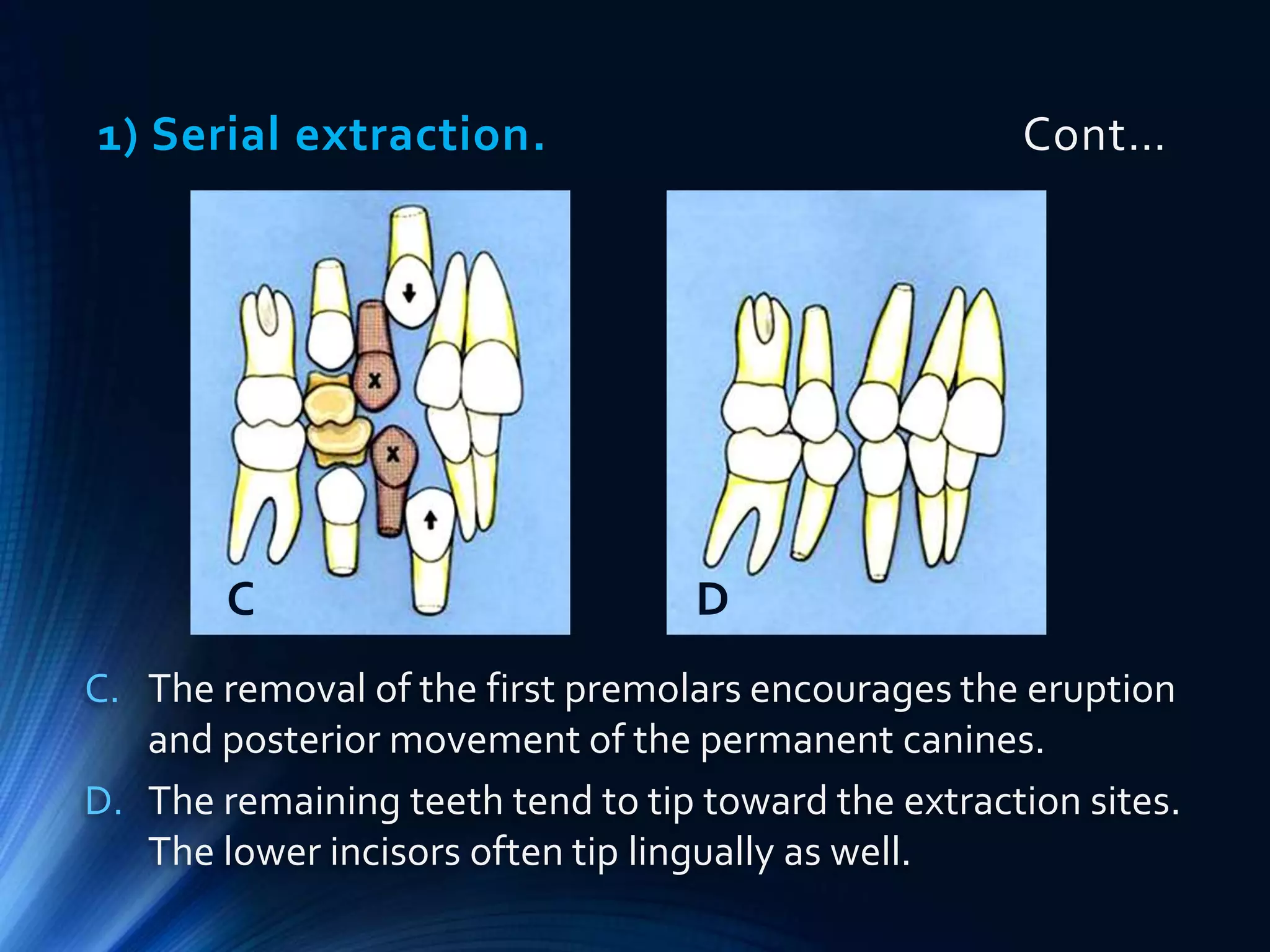 Preventive and interceptive orthodontics (basic) | PPTX