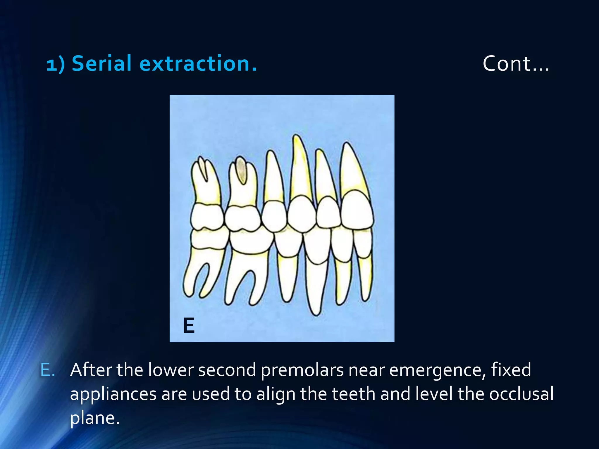Preventive and interceptive orthodontics (basic) | PPTX