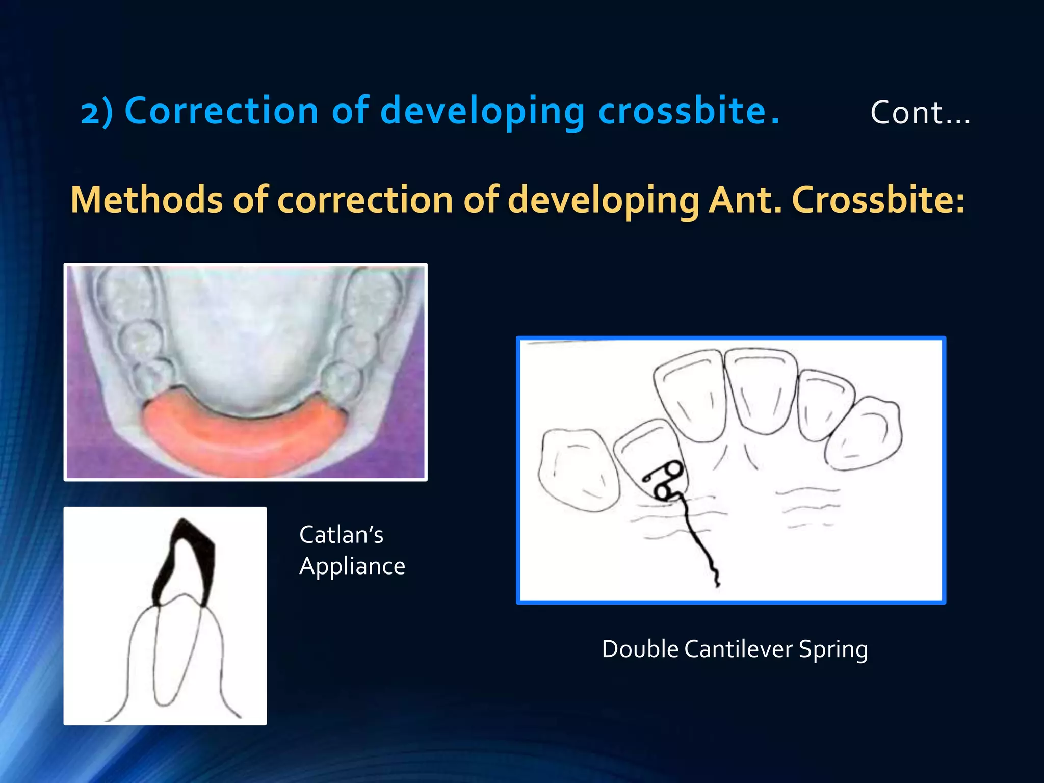 Preventive and interceptive orthodontics (basic) | PPTX