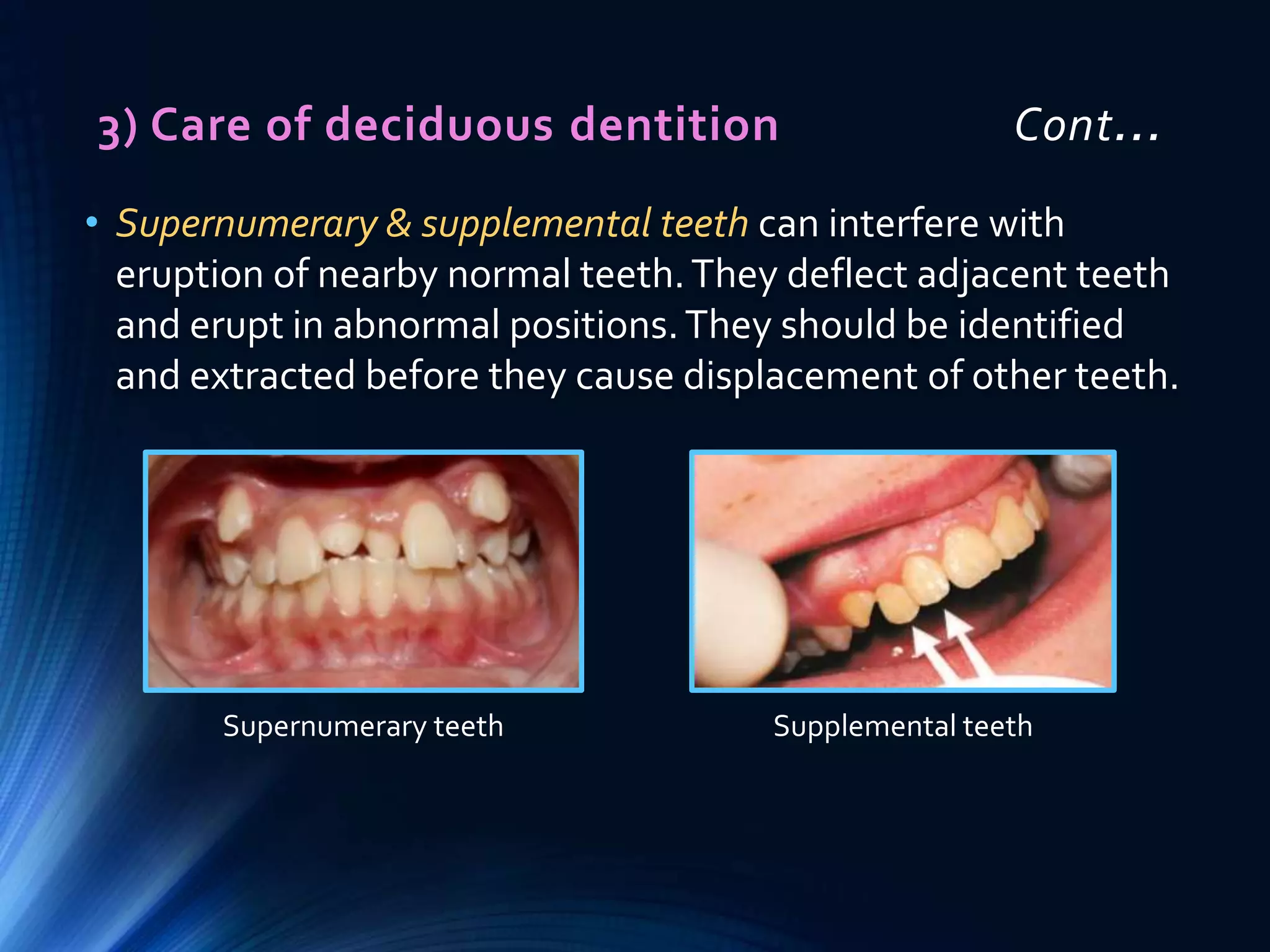 Preventive and interceptive orthodontics (basic) | PPTX