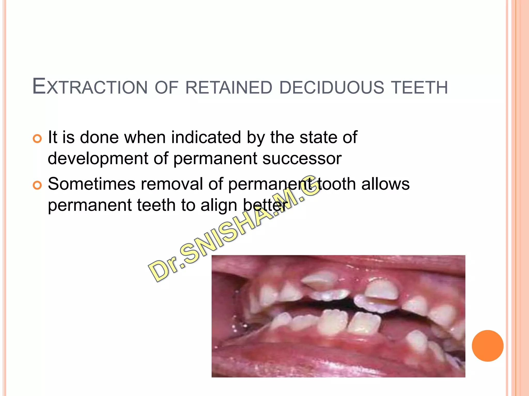 Preventive orthodontic procedure | PPTX