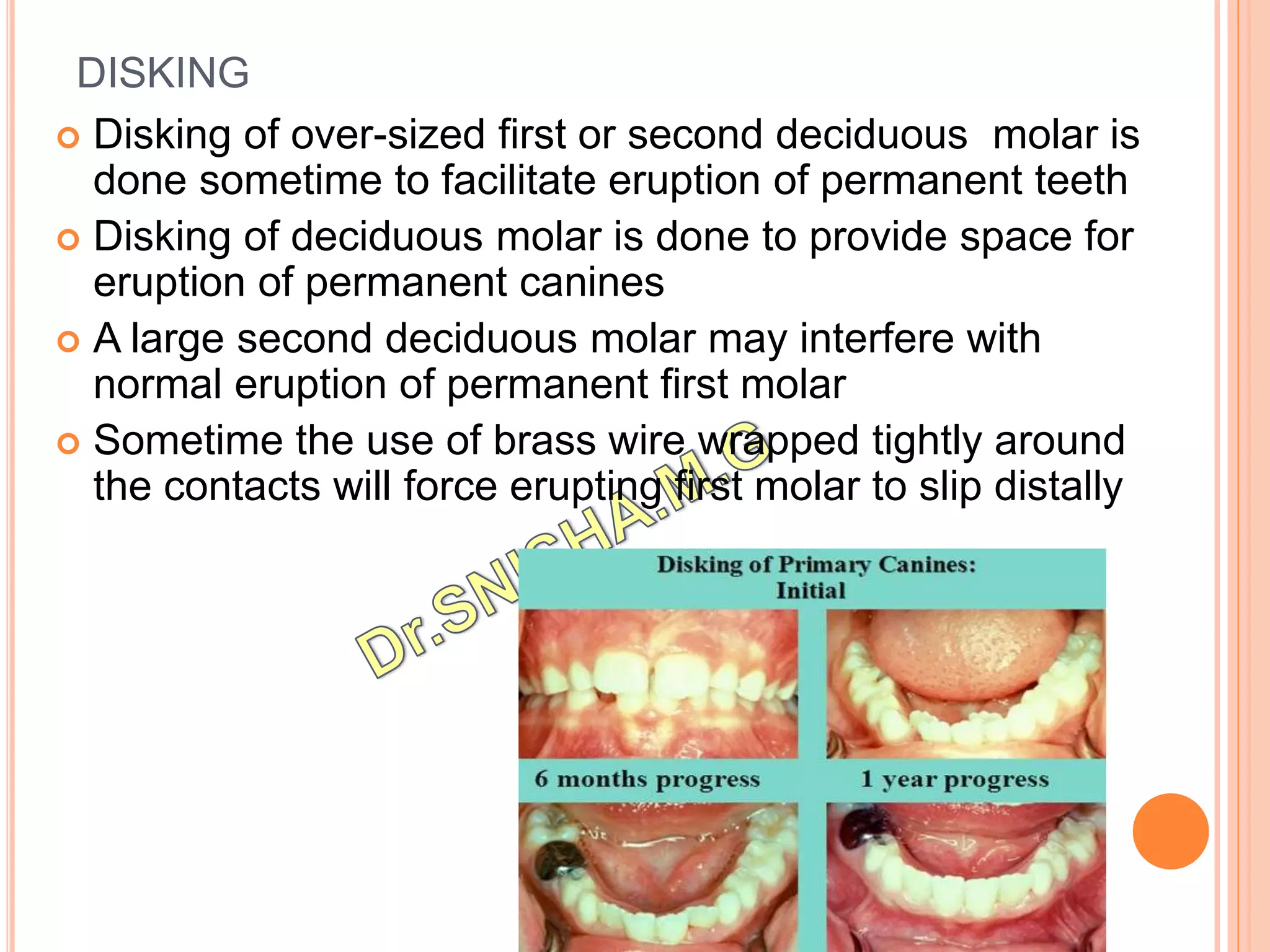 Preventive orthodontic procedure | PPTX