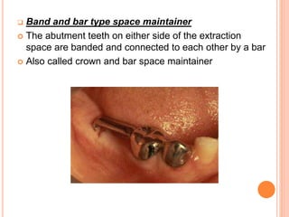 Preventive orthodontic procedure | PPTX