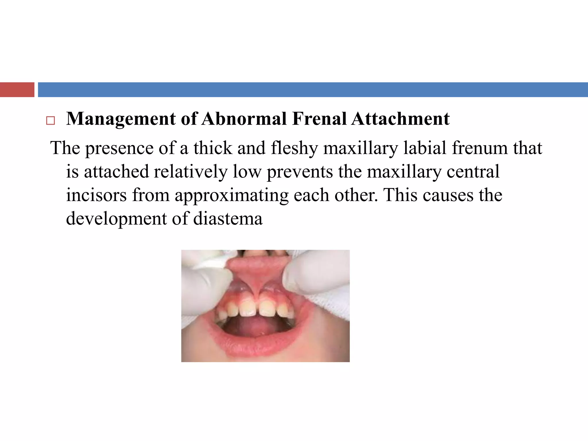 Preventive orthodontics | PPTX