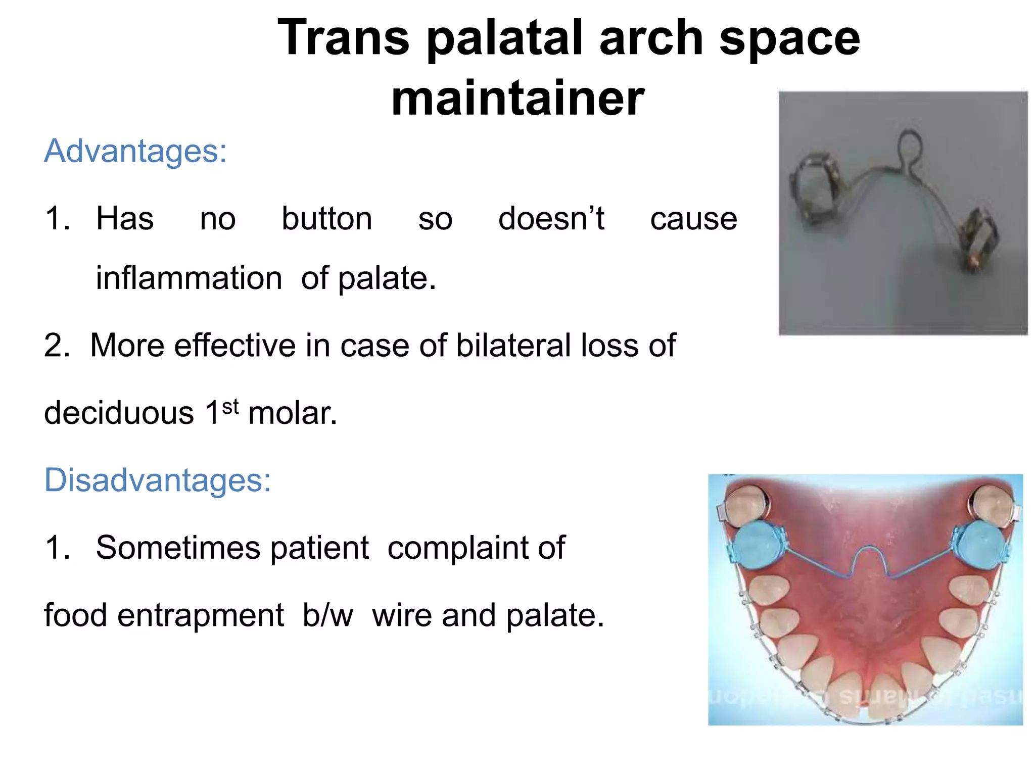Preventive orthodontics | PPTX