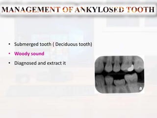 PREVENTIVE ORTHODONTICS.pptx