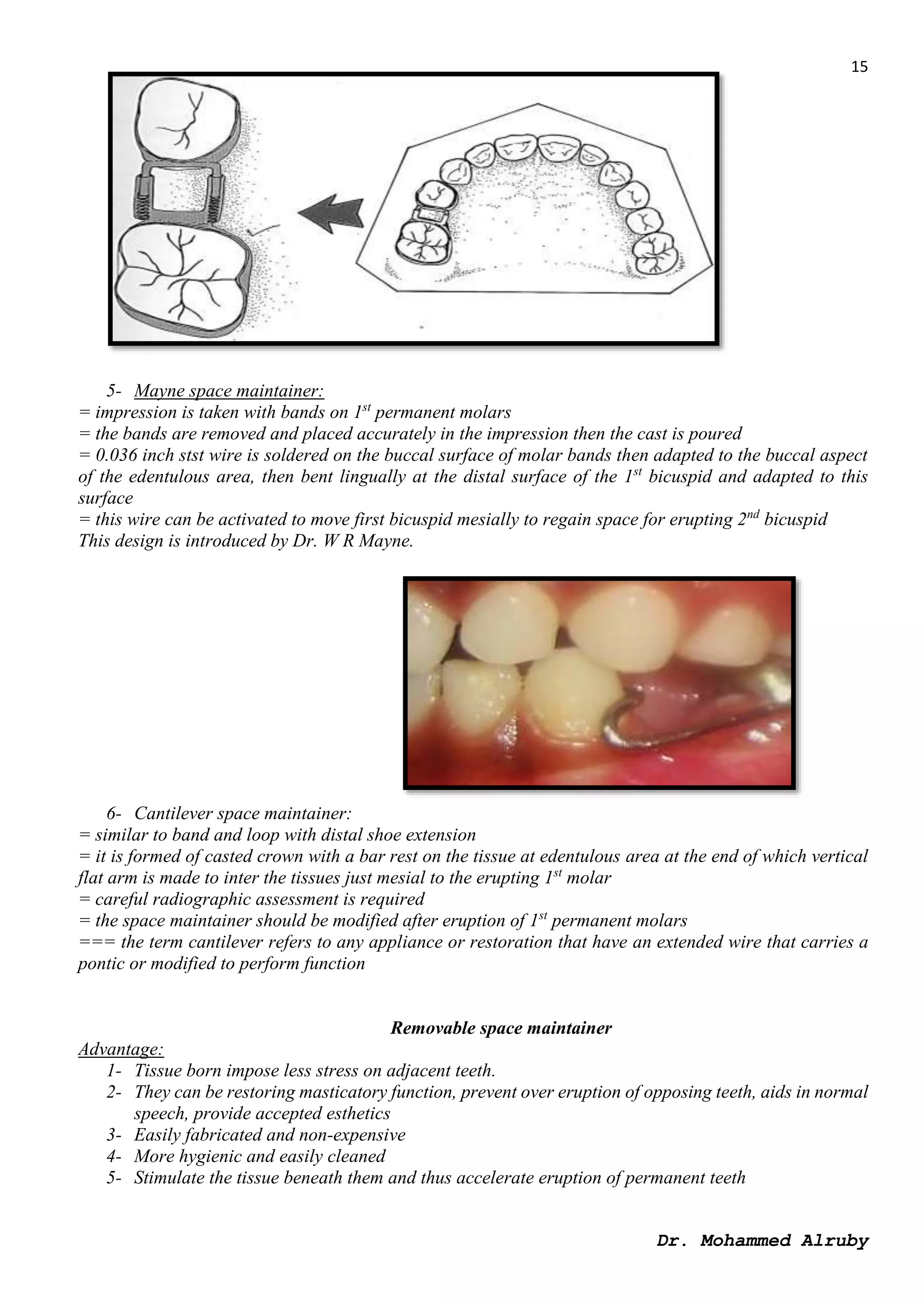 preventive orthodontics.docx