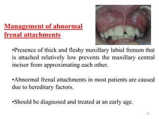 PREVENTIVE ORTHODONTICS.ppt