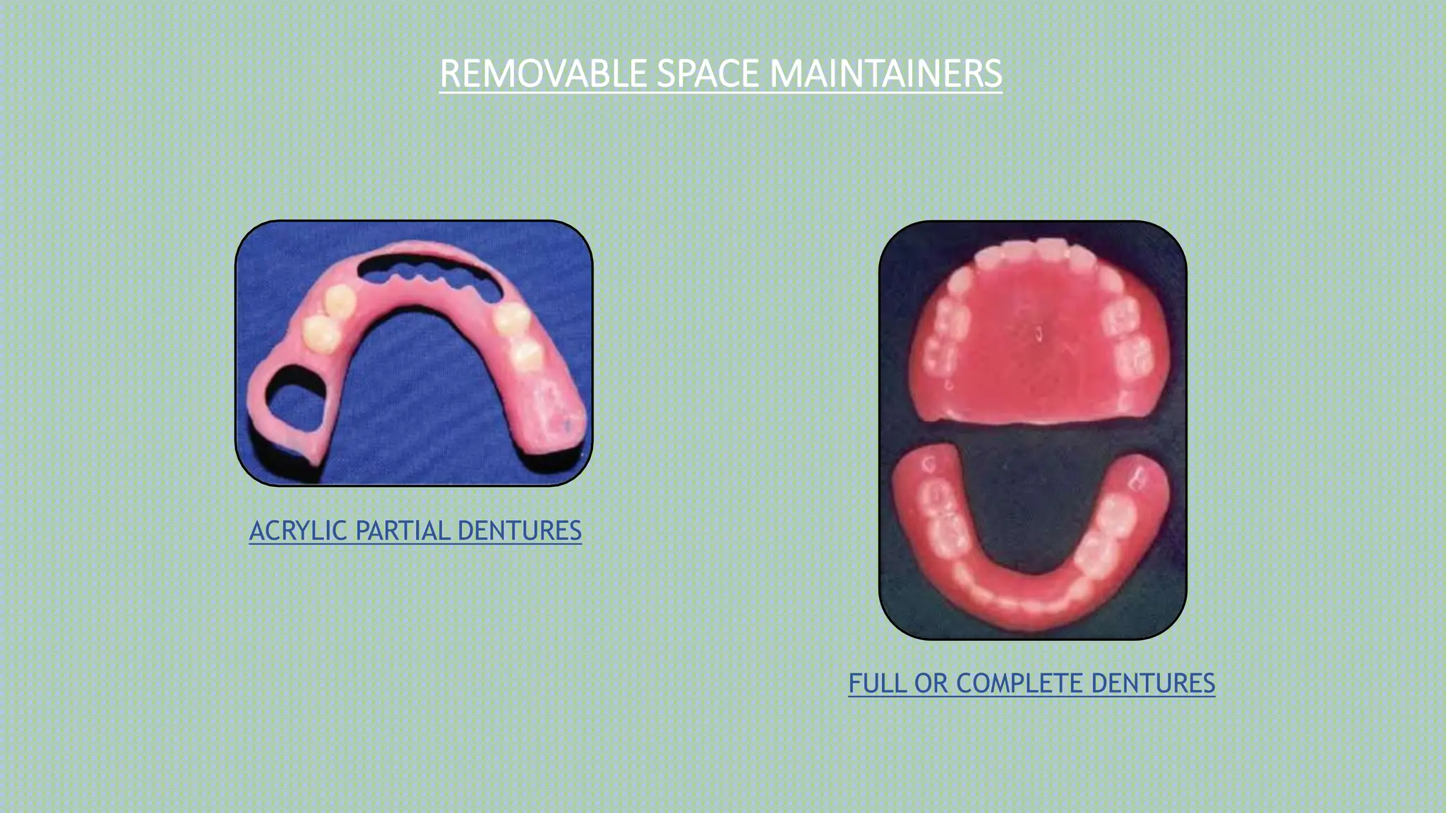 PREVENTIVE ORTHODONTICS WITH SPACE MANAGMENT.pptx