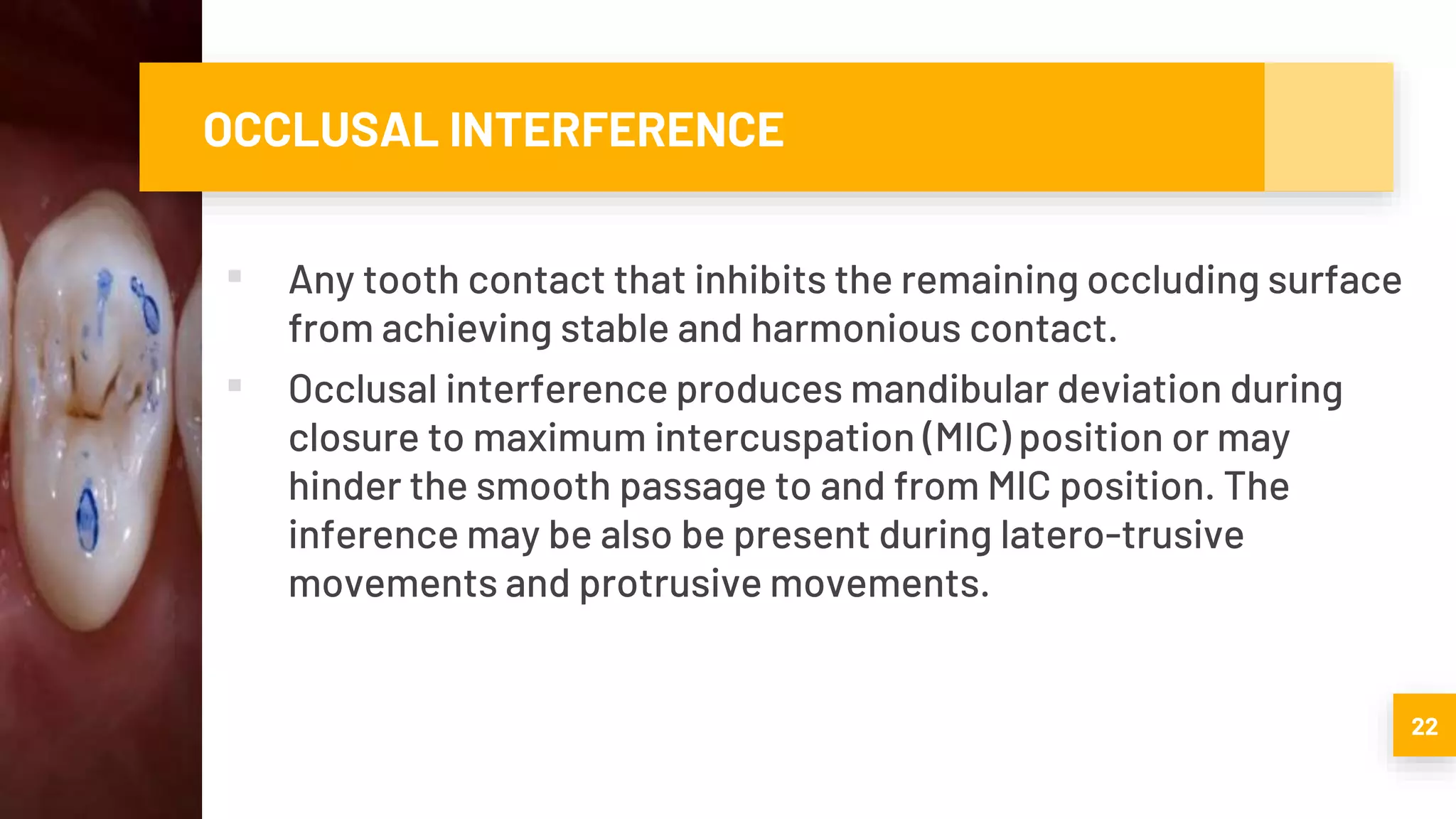 Preventive prosthodontics | PPTX