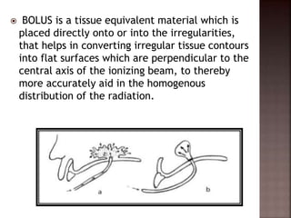 Preventive Prosthodontics for Head and Neck Radiotherapy.pptx