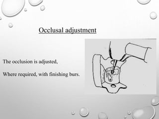 Preventive resin restoration | PPTX