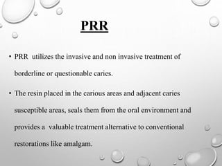 Preventive resin restoration | PPTX