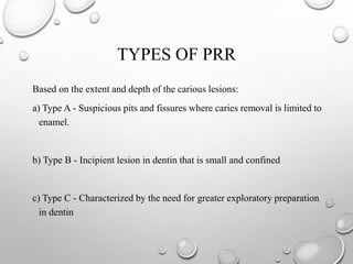 Preventive resin restoration | PPTX