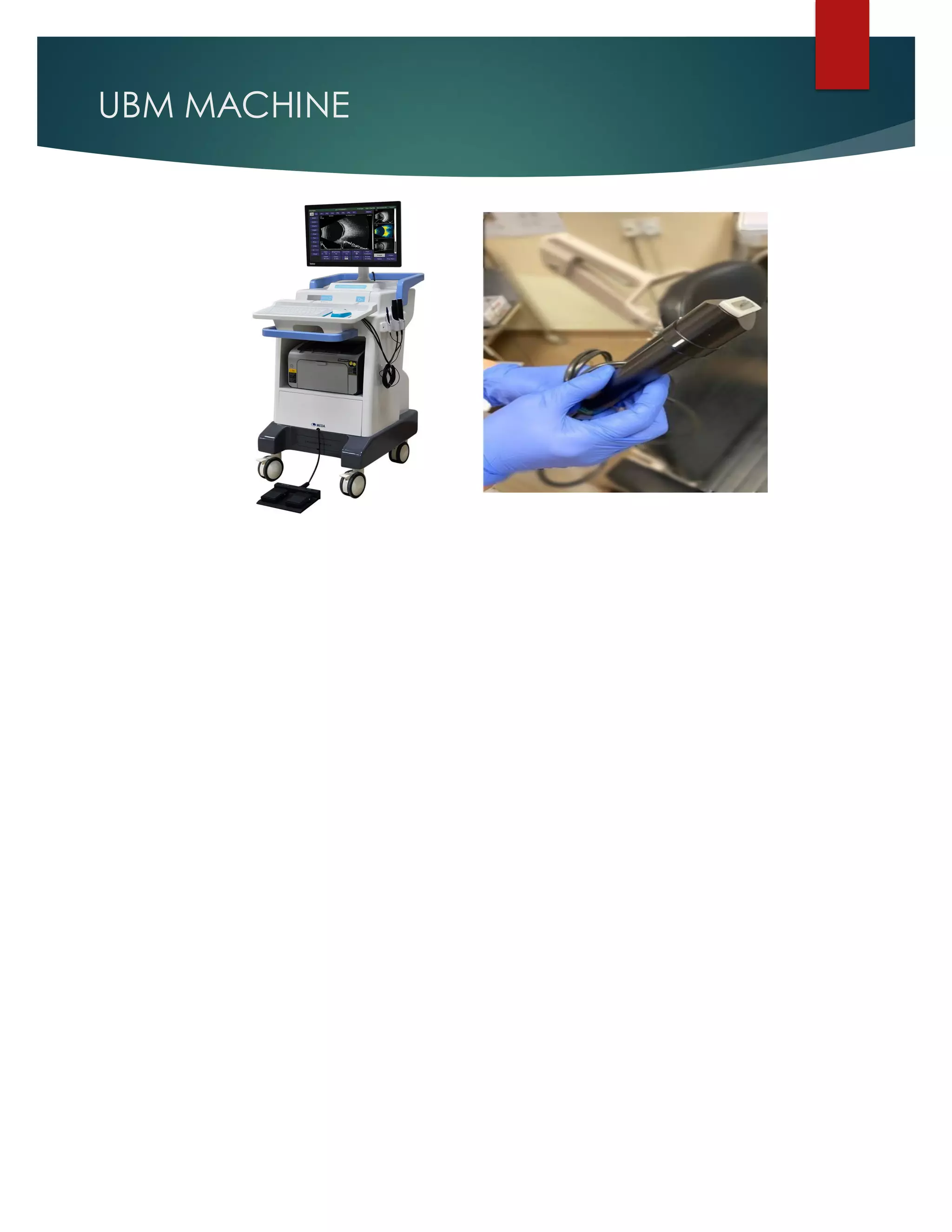 Ultra sound biomicroscopy.PDF