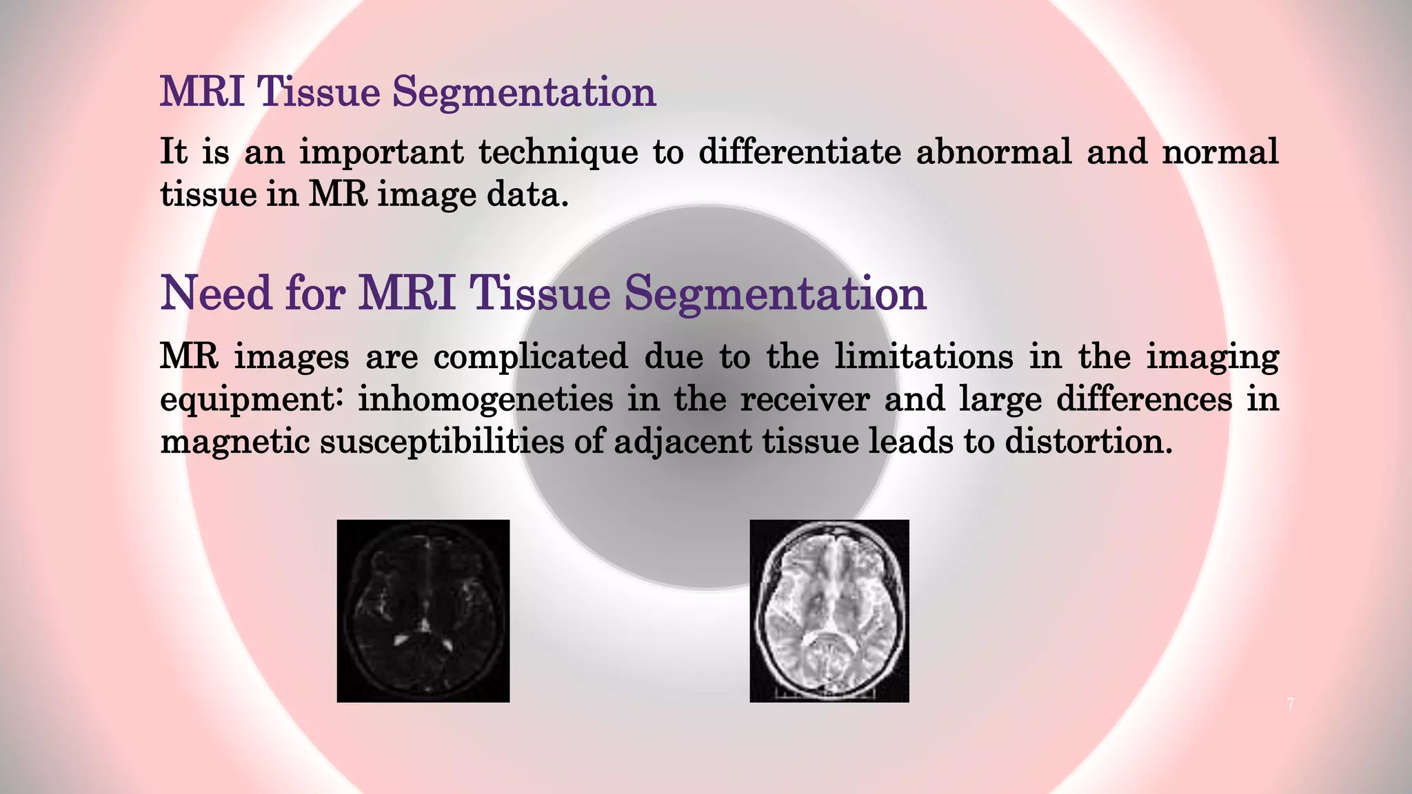 MRI Tissue Segmentation basics | PPTX