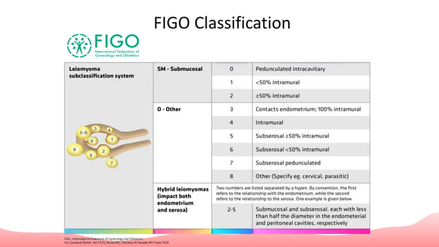 Medical Management of Fibroids Part 1 | PPT