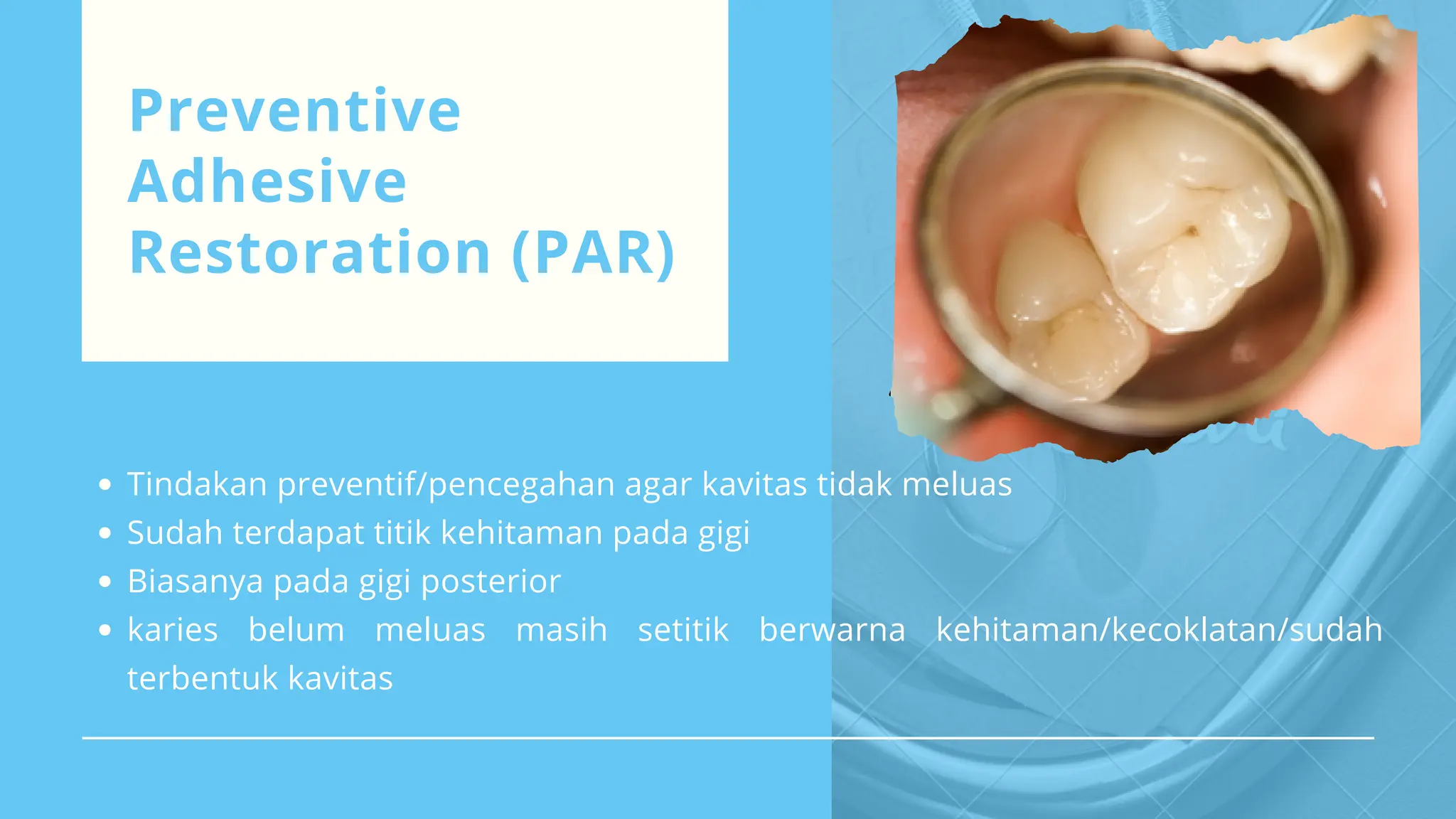 Preventif, dan Kuratif dalam Kedokteran Gigi Anak | PDF