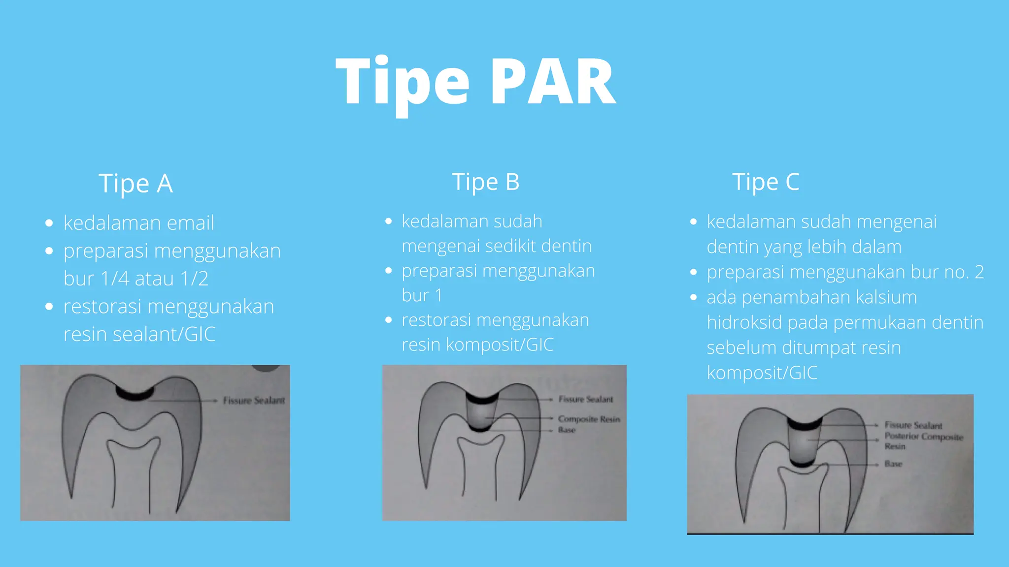 Preventif, dan Kuratif dalam Kedokteran Gigi Anak | PDF
