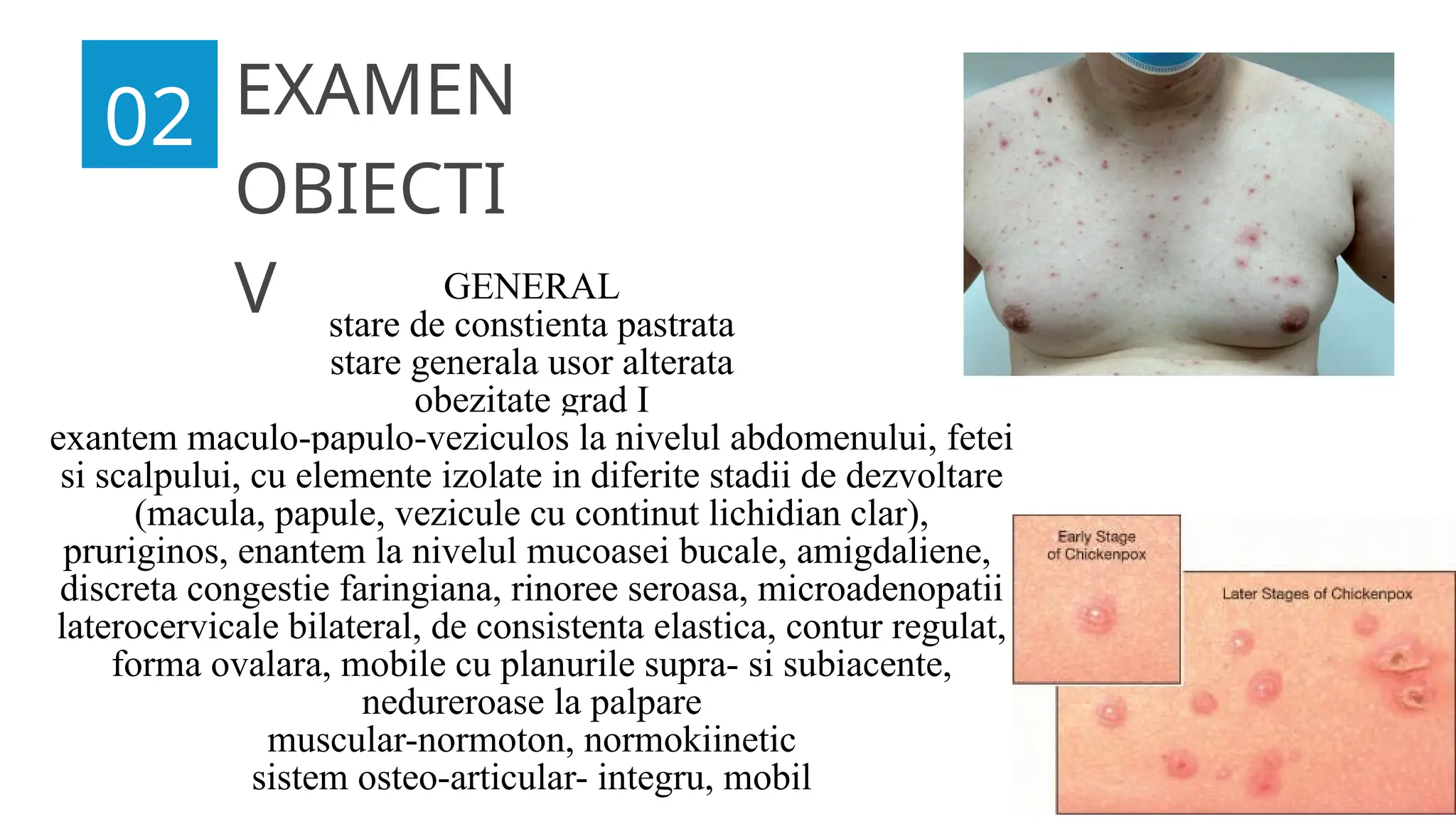 prezentare boli infectioase de caz clinic varicela .pptx