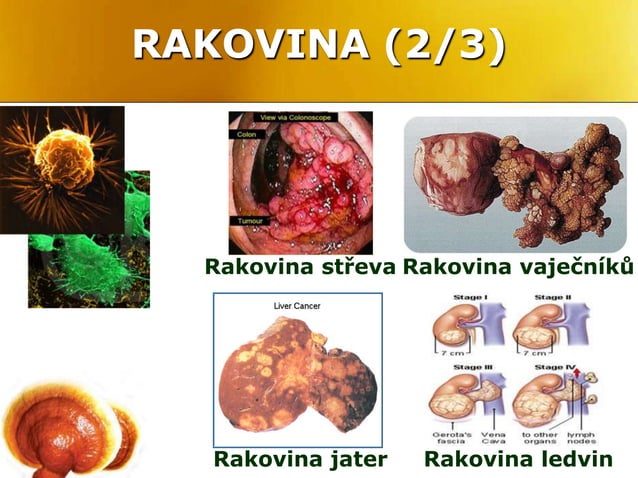 Prezentace ganoderma | PDF