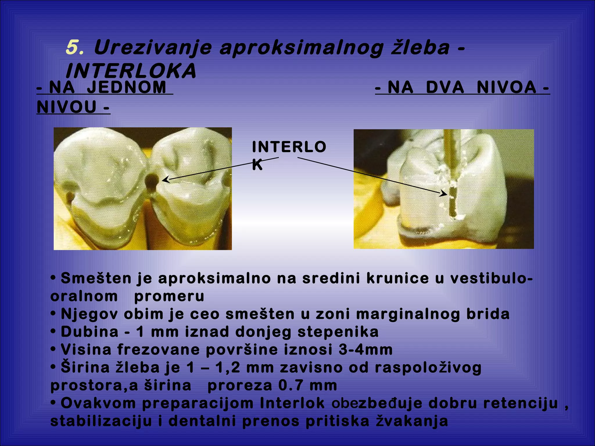 Frez tehnika u zubnoj protetici | PPT